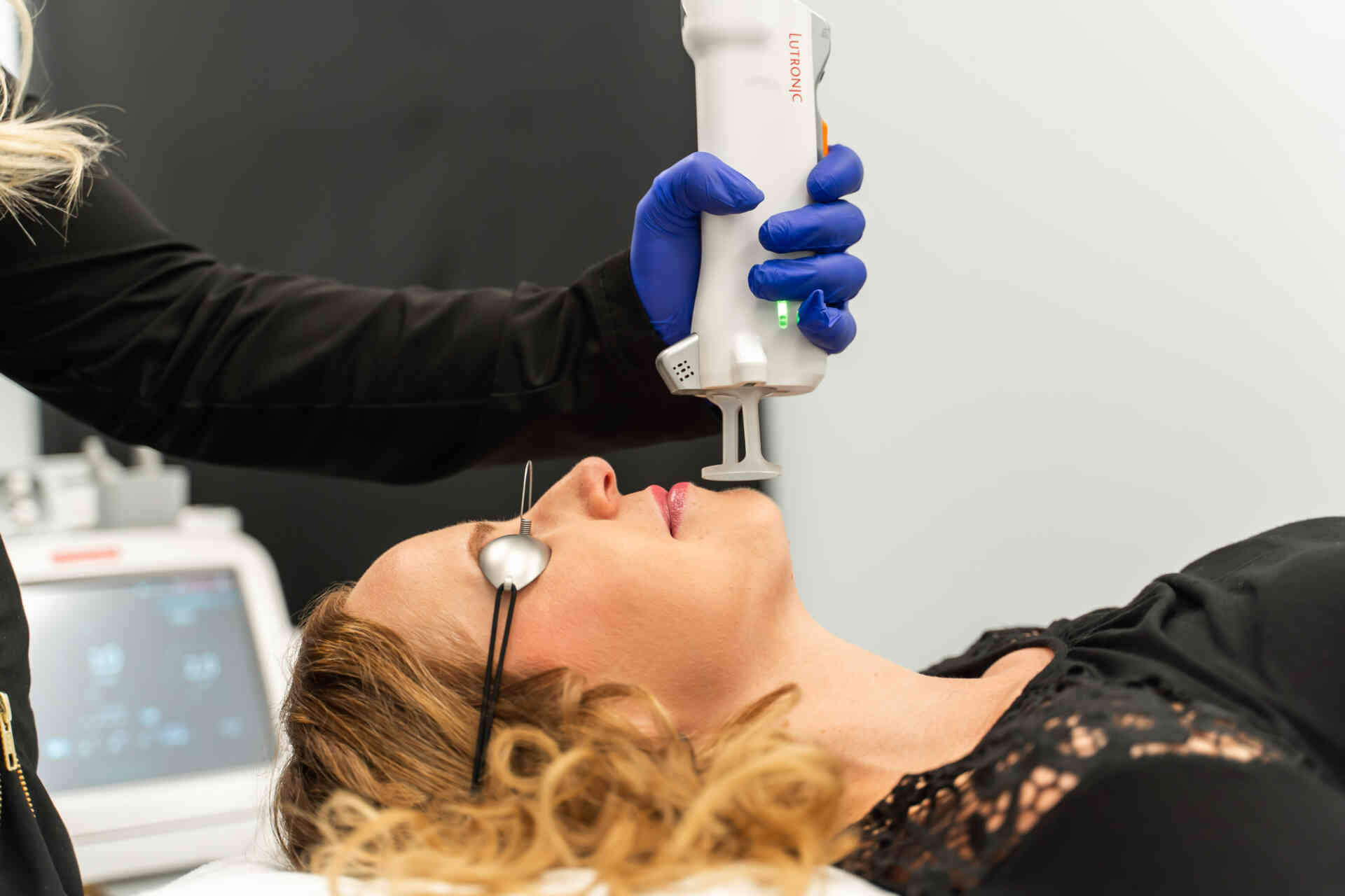 Laser Services with Clarity II™ | Beauty Rewind